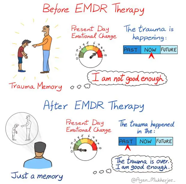 How Can EMDR Therapy Help You? How Can EMDR Therapy Help You?